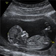 Listen to Tools 4 Life Volume III Chapter I The Rest of the Story, 4 ...